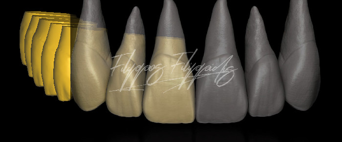 Customized :: Artisanal dental libraries